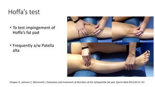 Approach to anterior knee pain.pptx