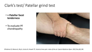 Approach to anterior knee pain.pptx
