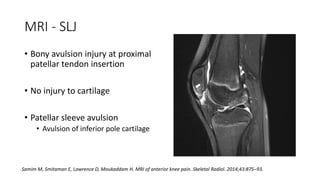 Approach to anterior knee pain.pptx
