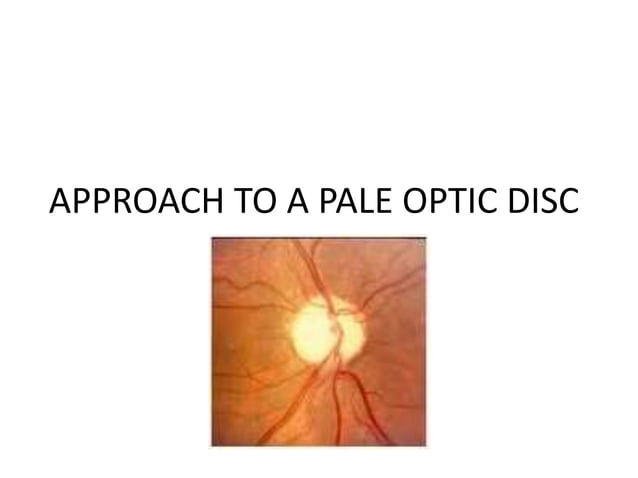 Approach to a pale optic disc | PPTX | Blood Disorders | Diseases and ...