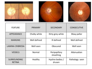 Approach to a pale optic disc | PPT