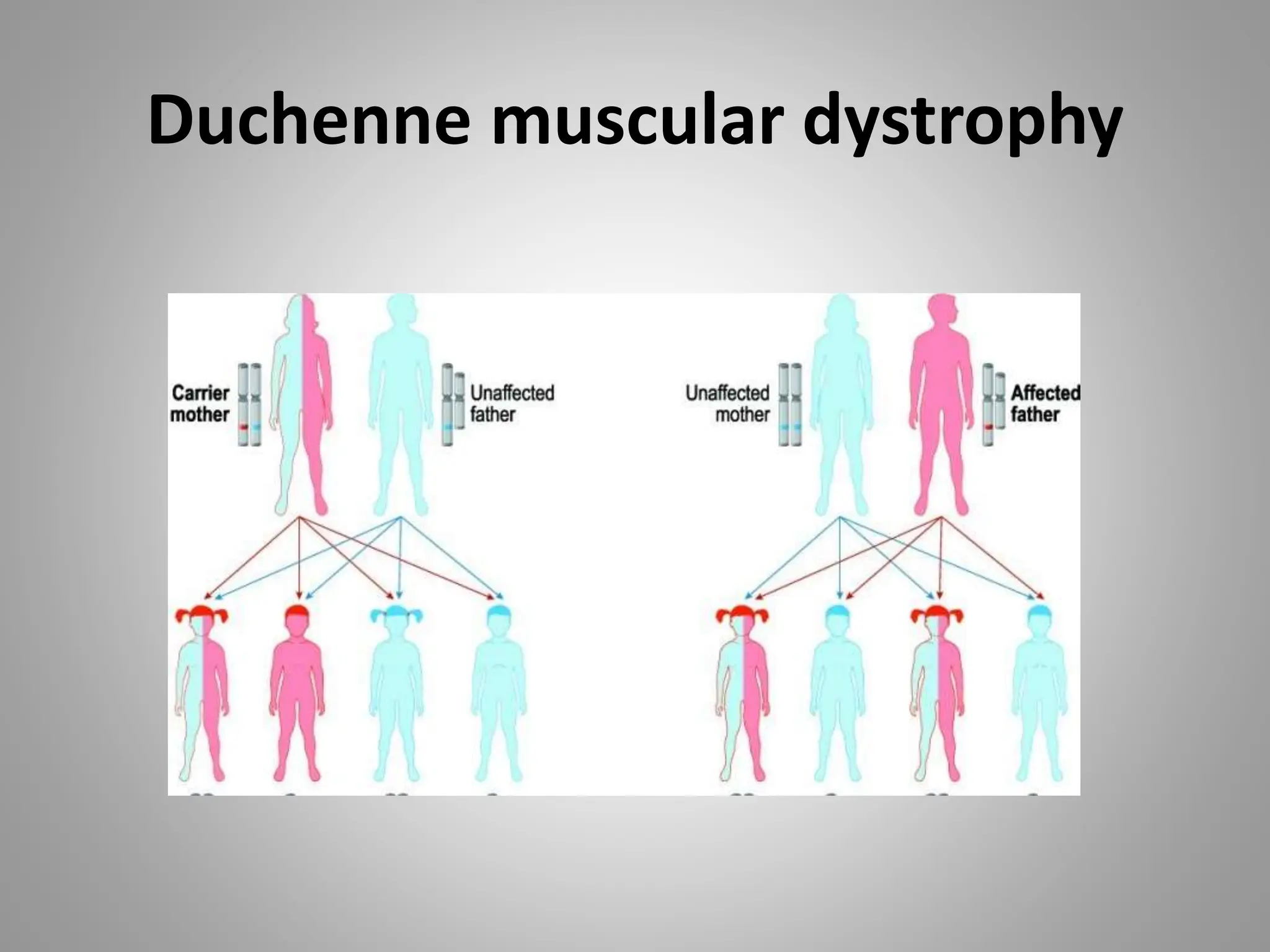 Approach to a patient of muscle disease with muscular dystrophy.pptx