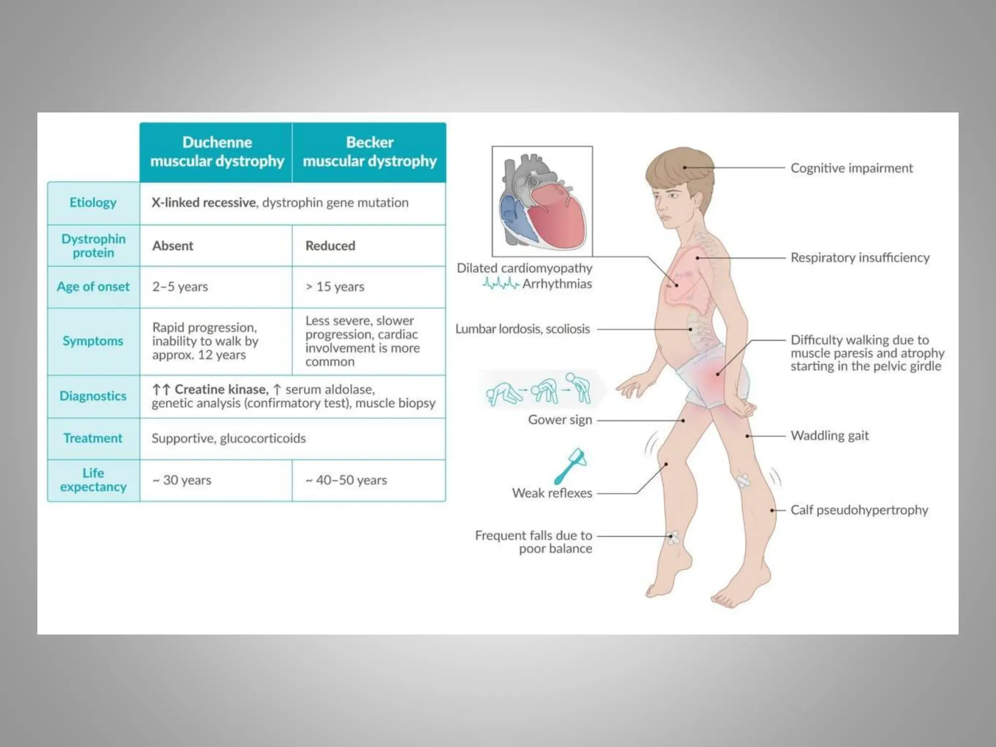 Approach to a patient of muscle disease with muscular dystrophy.pptx
