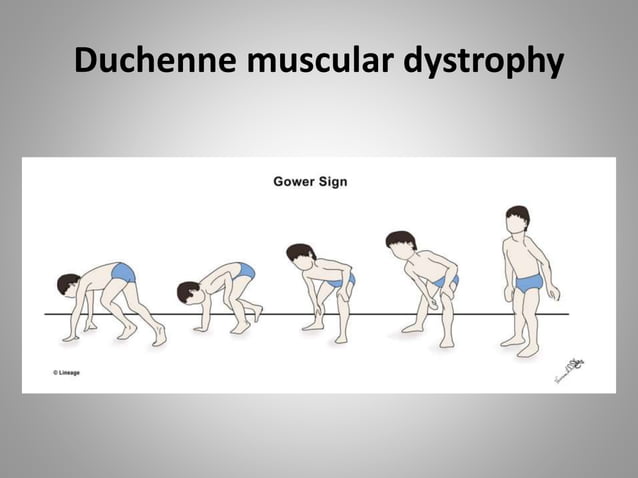 Approach to a patient of muscle disease with muscular dystrophy.pptx