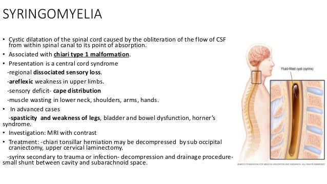 Approach to a patient of spastic paraplegia