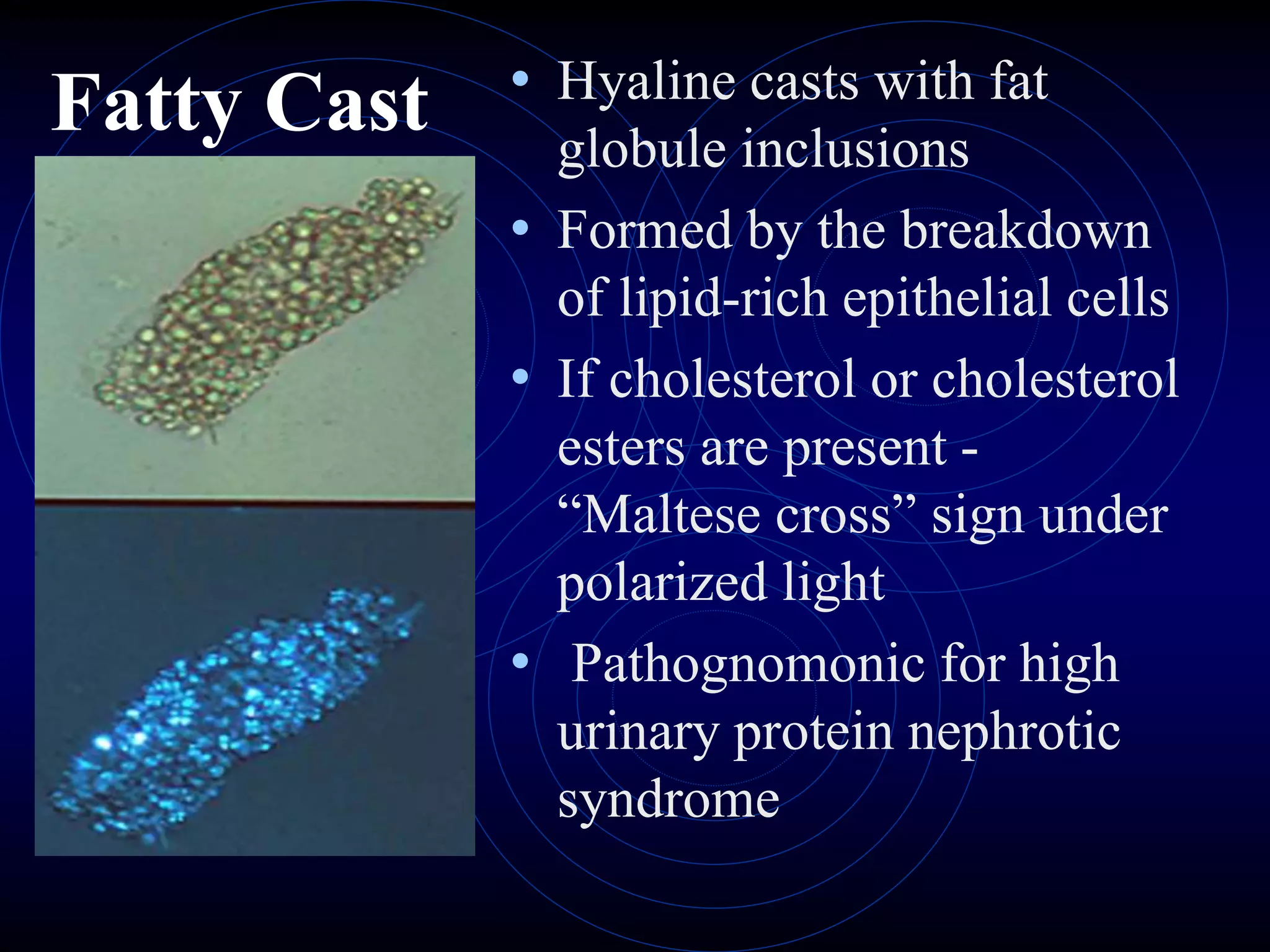 Approach to a patient with active urinary sediments | PPTX