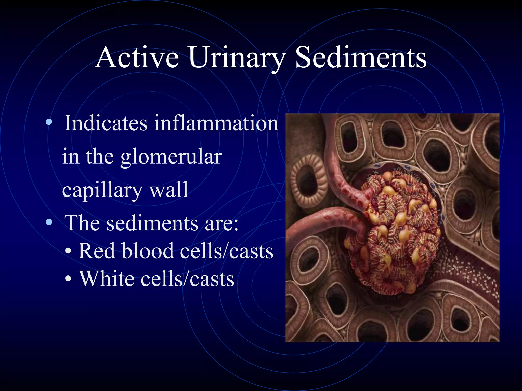 Approach to a patient with active urinary sediments | PPTX