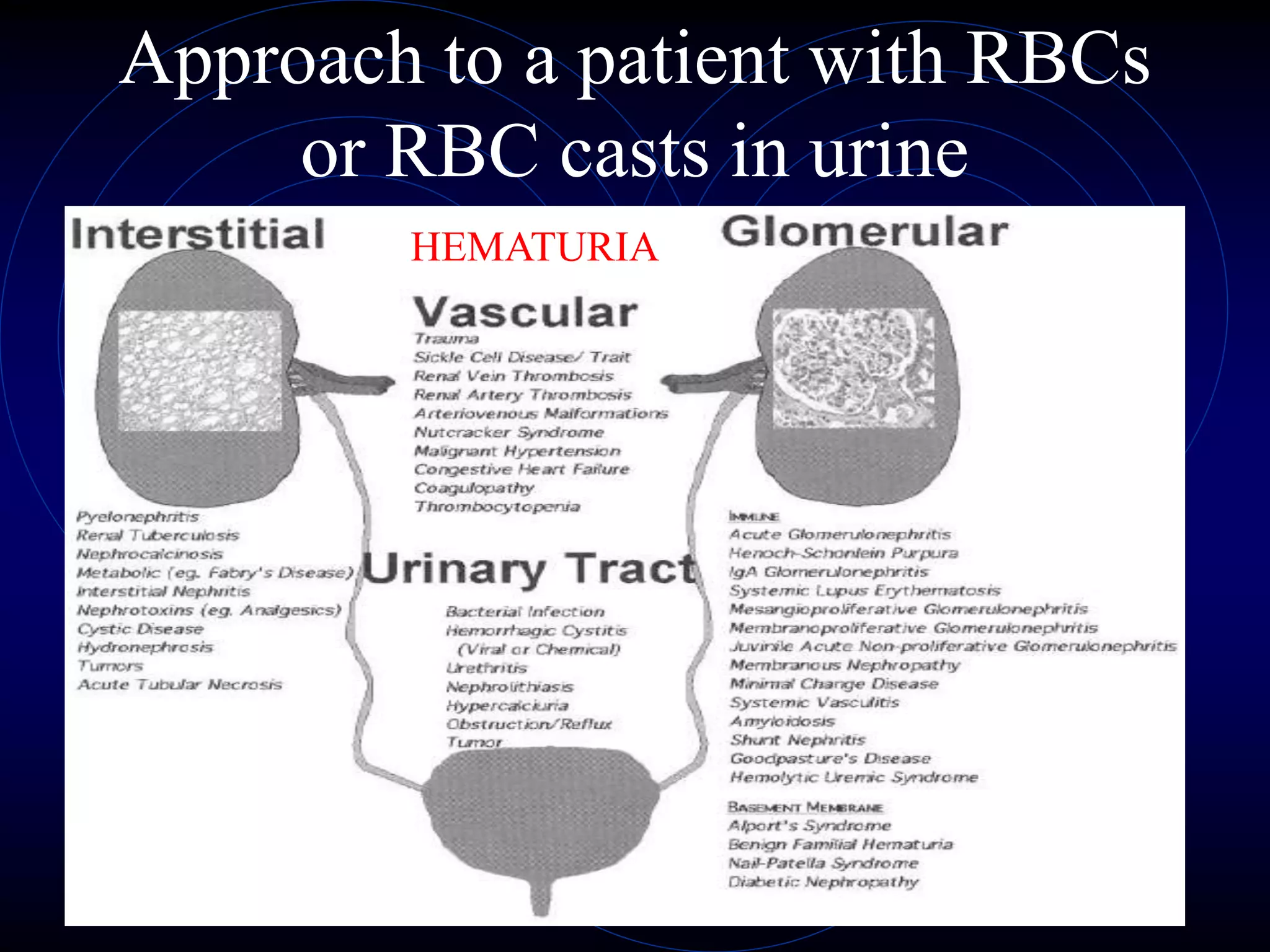 Approach to a patient with active urinary sediments | PPTX