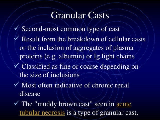 Approach to a patient with active urinary sediments