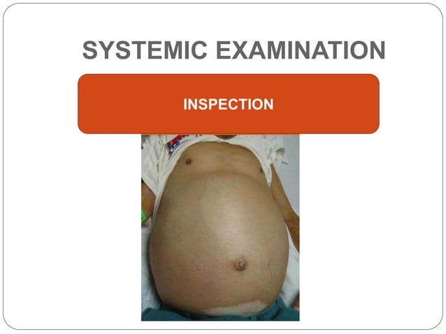 Approach to a patient with ascites | PPTX | Digestive Disorders ...