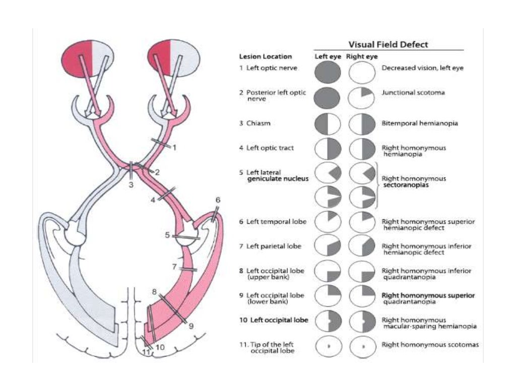 Approach to a patient with bilateral vision loss