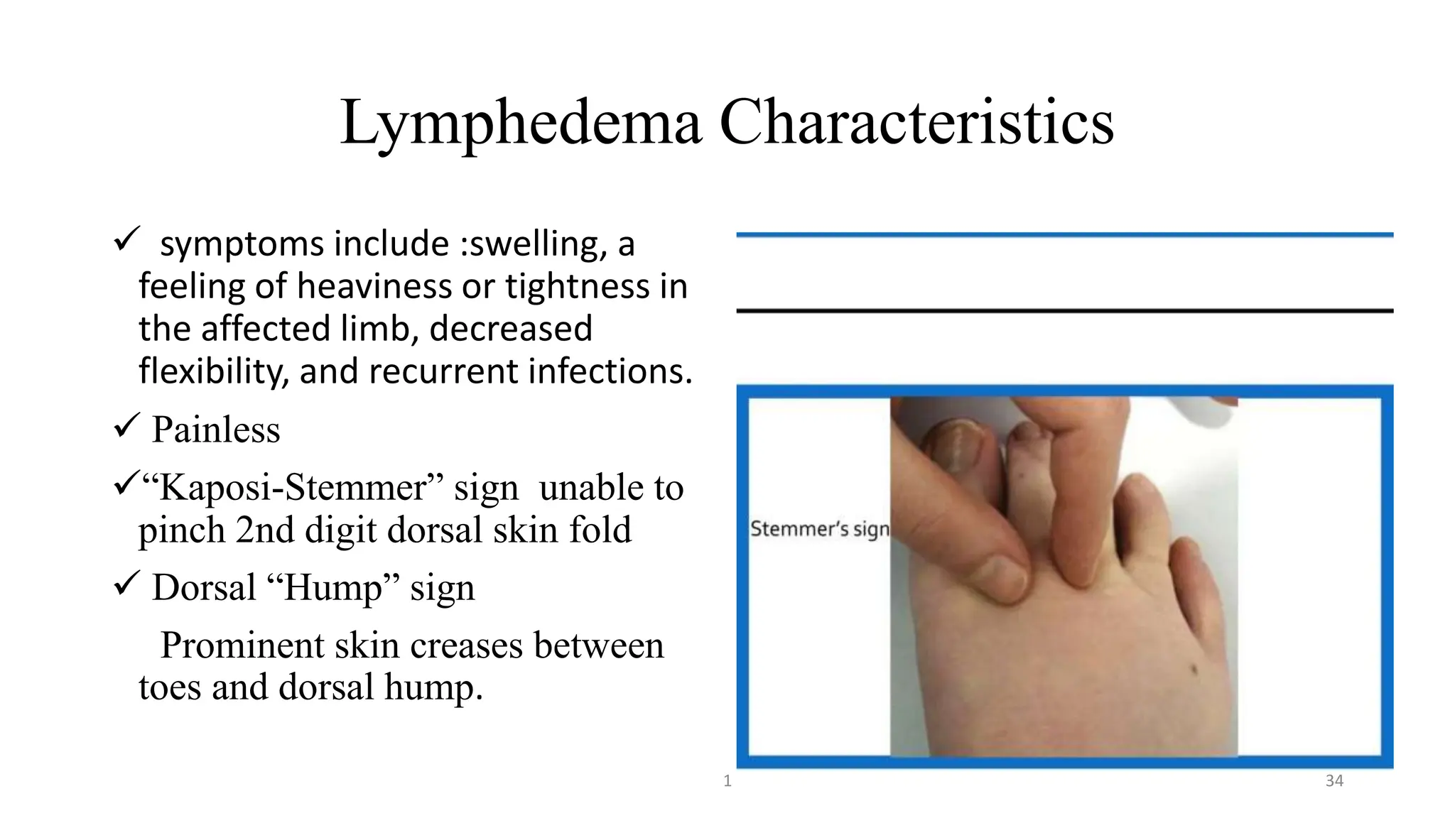 Approach to a patient with body swelling-1 new.pptx