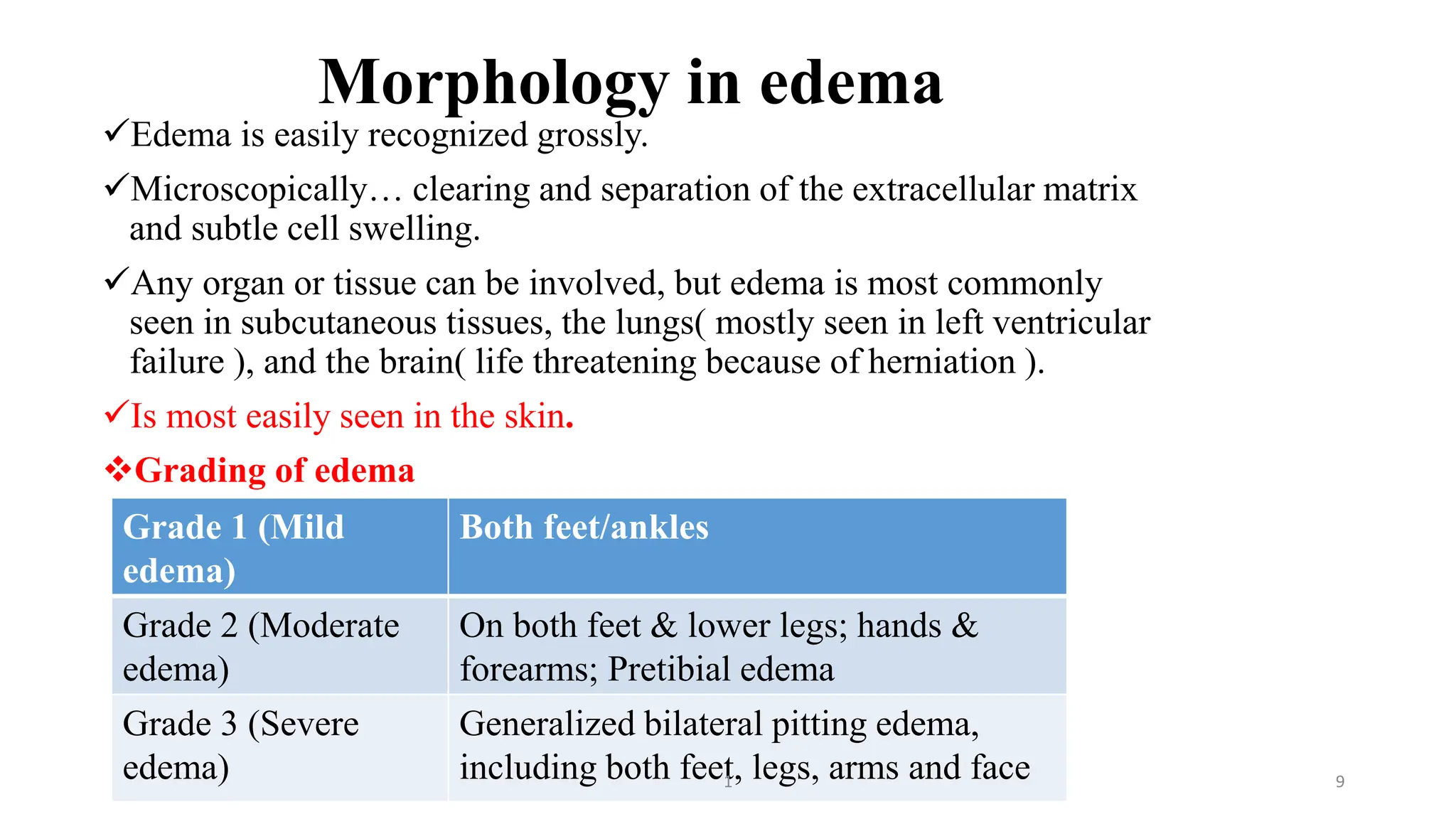 Approach to a patient with body swelling-1 new.pptx