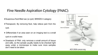 Comprehensive Approach to Diagnosis and Management of Breast Lumps | PPTX