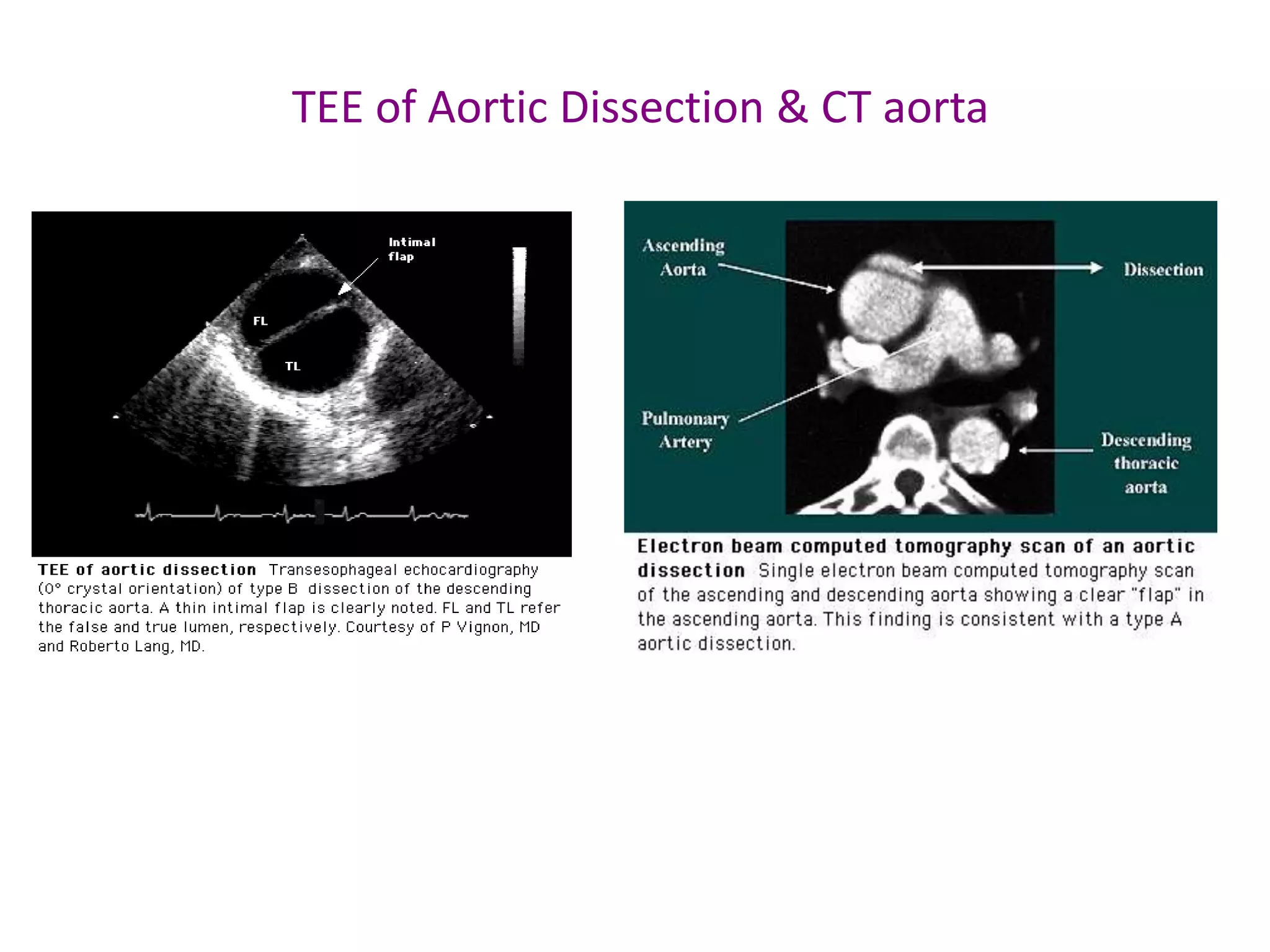 Approach to a patient with cardiovascular disease | PPTX