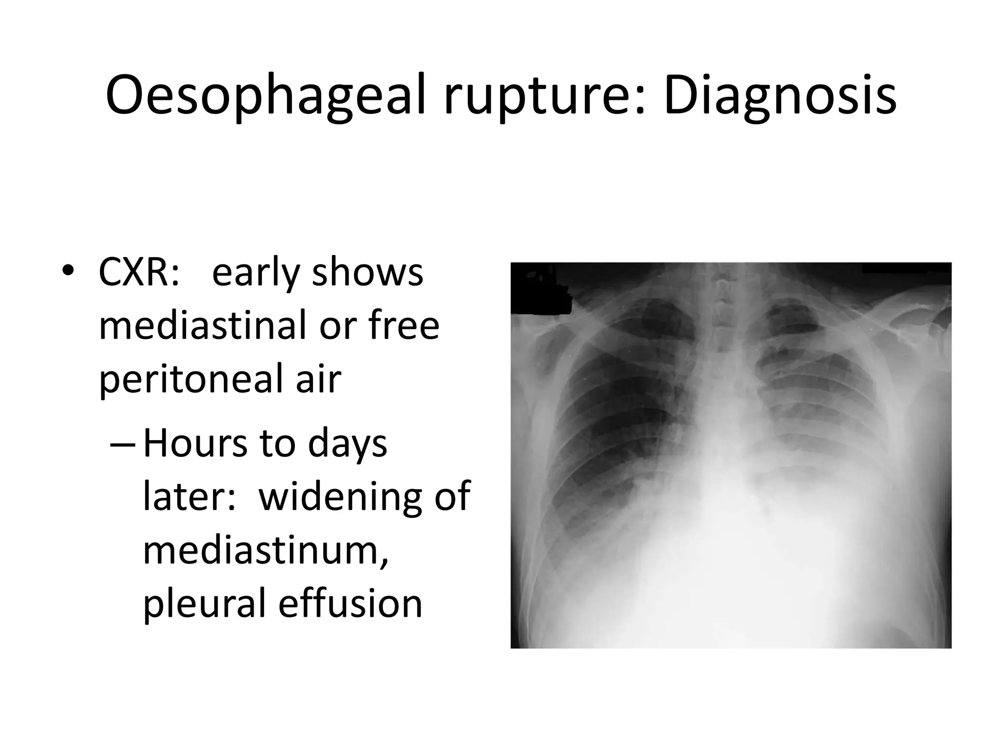 Approach to a patient with cardiovascular disease | PPTX