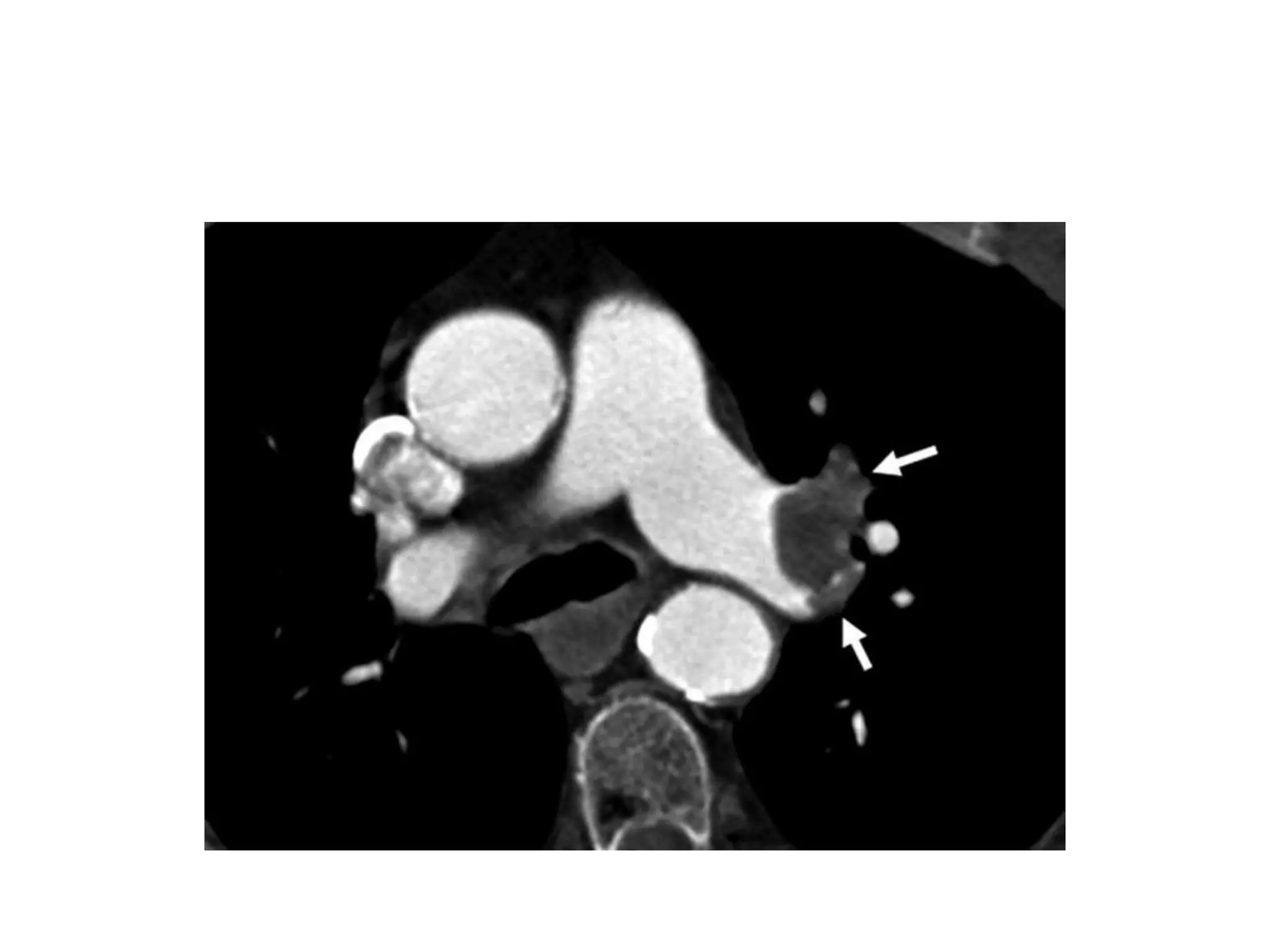 Approach to a patient with cardiovascular disease | PPTX
