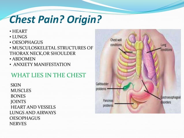 Approach to a patient with chest pain | PPT
