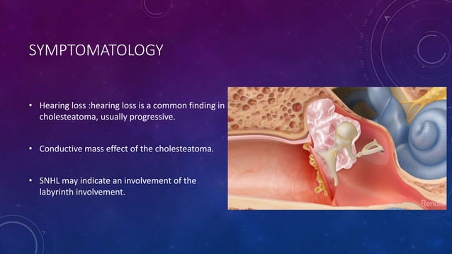 Approach to a patient with cholesteatoma | PPTX | Ear, Nose and Throat ...