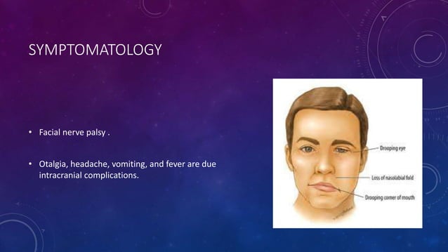 Approach to a patient with cholesteatoma | PPTX | Ear, Nose and Throat ...