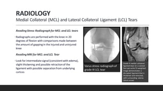 APPROACH TO A PATIENT WITH CHRONIC KNEE PAIN.pdf