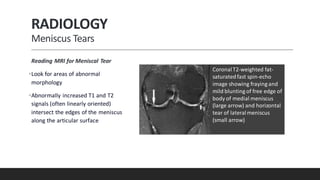 APPROACH TO A PATIENT WITH CHRONIC KNEE PAIN.pdf