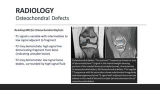 APPROACH TO A PATIENT WITH CHRONIC KNEE PAIN.pdf