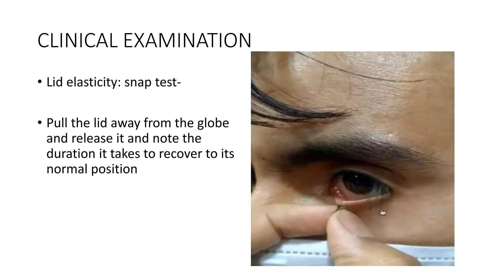 Approach to a patient with ectropion, entropion, symblepharon.pptx