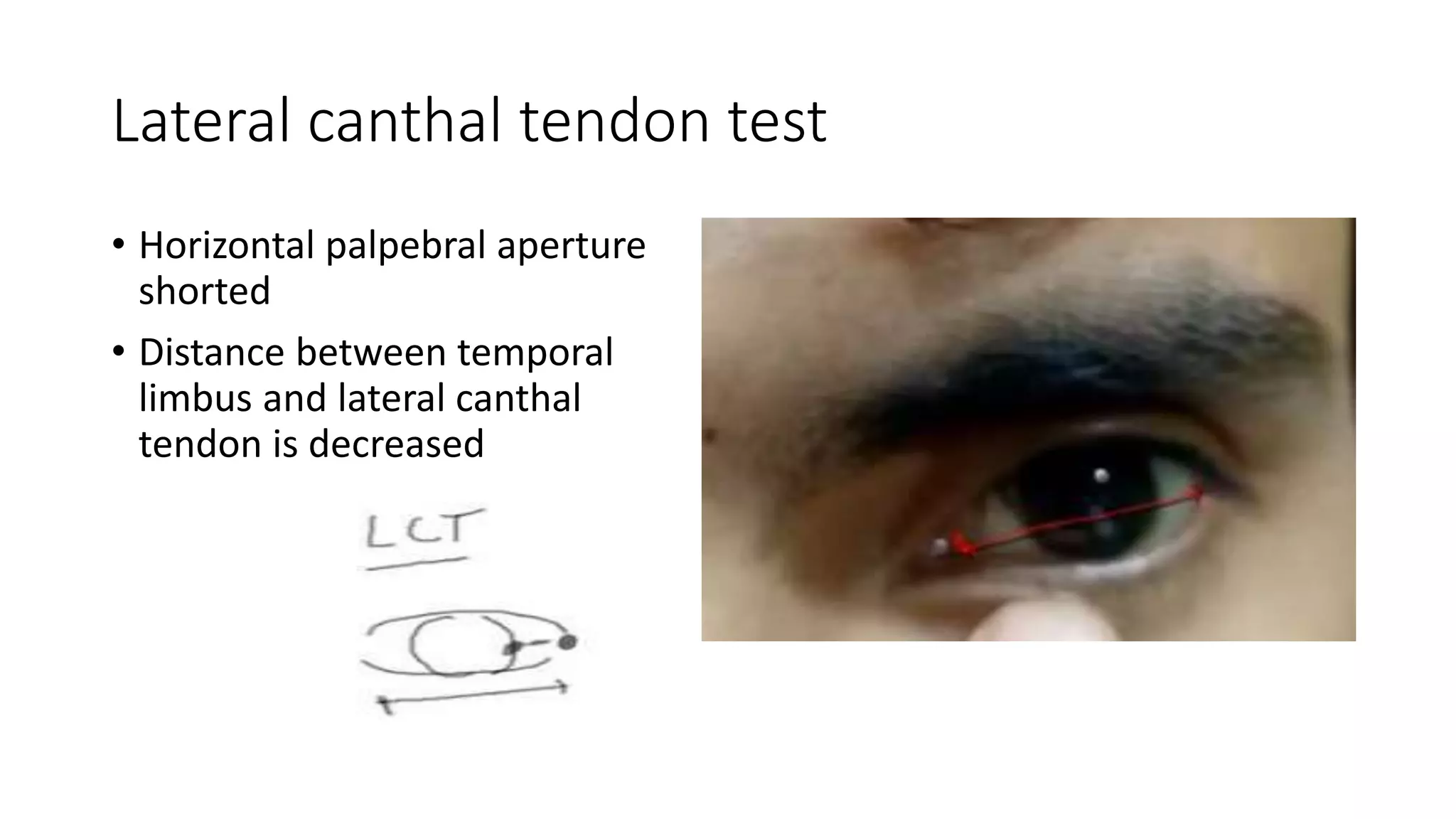 Approach to a patient with ectropion, entropion, symblepharon.pptx