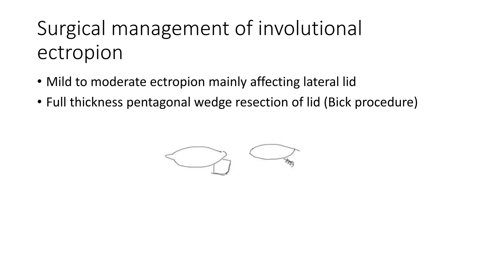 Approach to a patient with ectropion, entropion, symblepharon.pptx