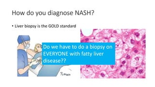 Approach to a patient with Fatty Liver.pptx