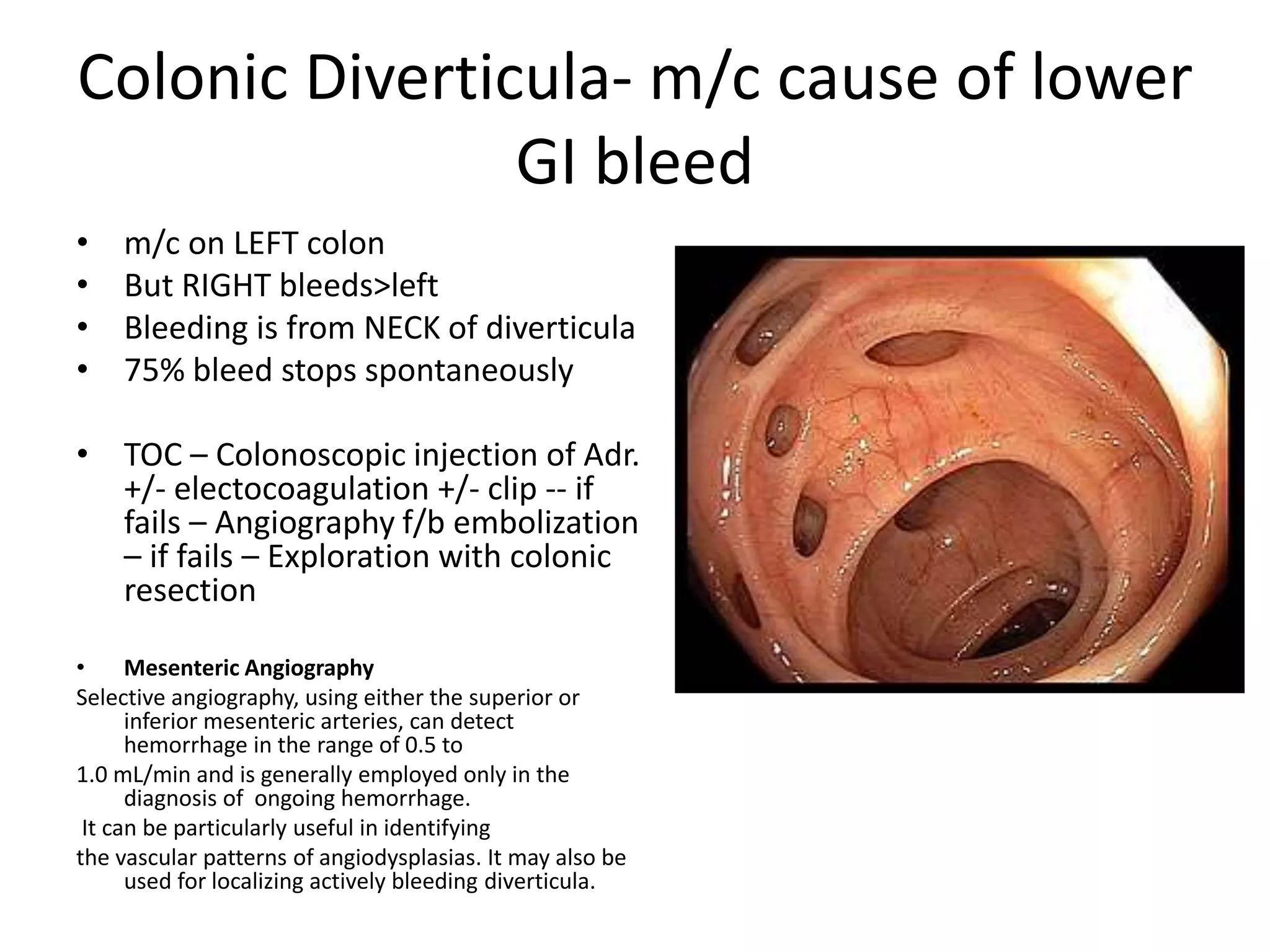 Approach to a patient with GI hemorrhage | PPTX