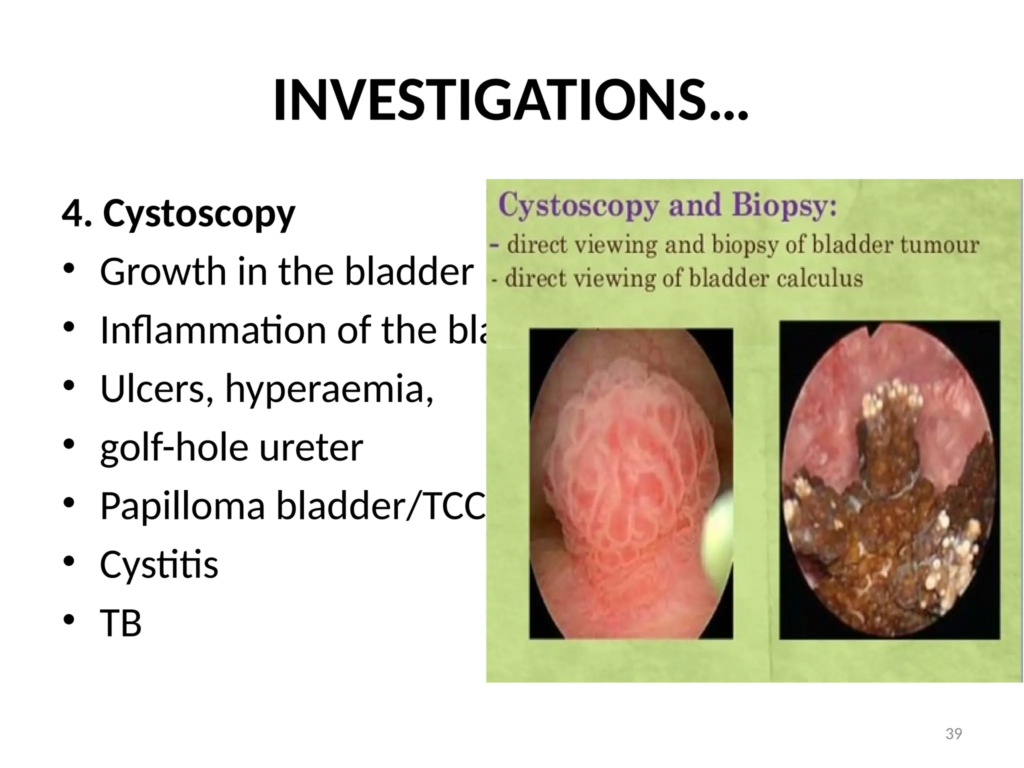 Approach to a patient with hematuria.pptx