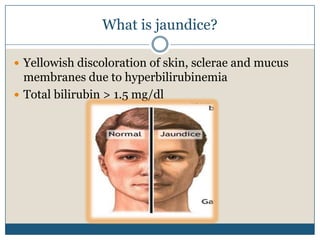 Approach To A Patient With Jaundice | PPTX