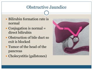 Approach To A Patient With Jaundice | PPTX