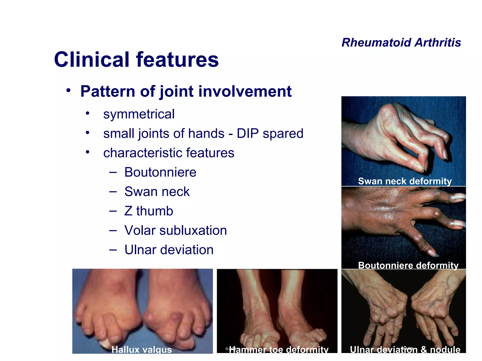 Approach To A Patient With Polyarthritis | PPT