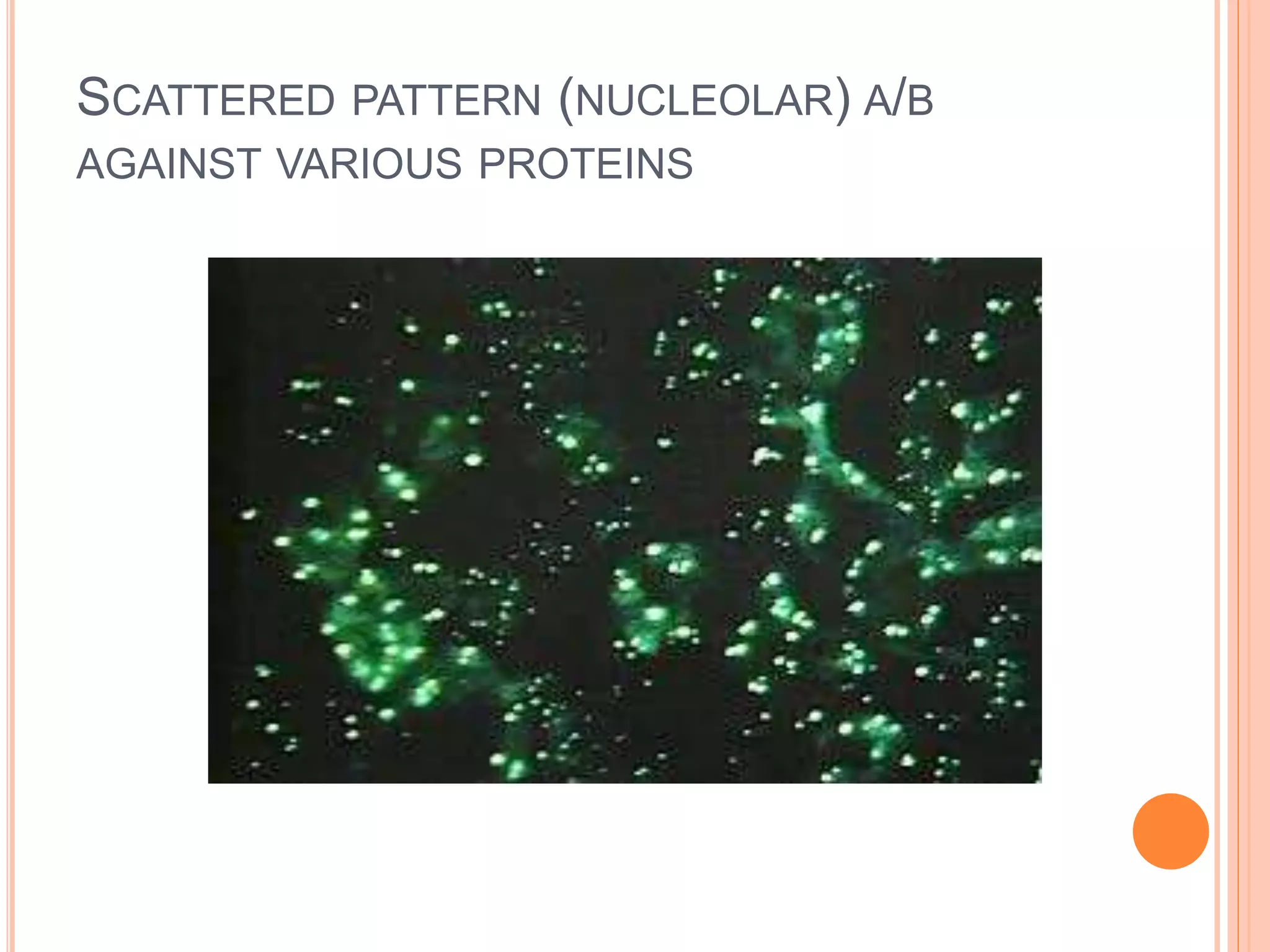 Approach to a patient with positive ana levels (2) | PPTX