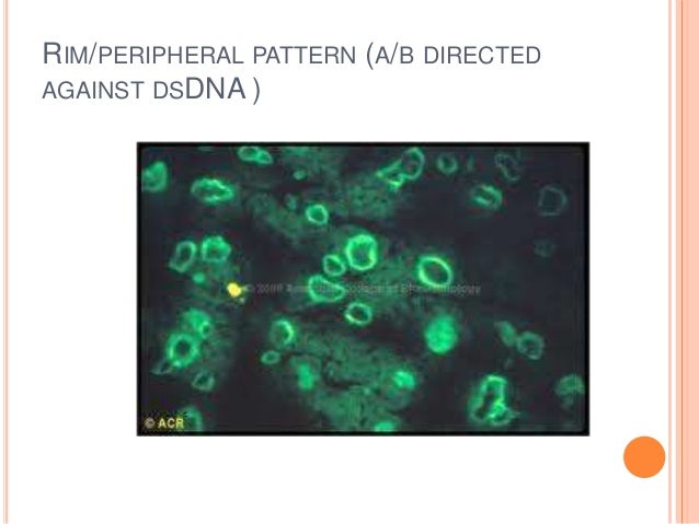 Approach to a patient with positive ana levels (2)