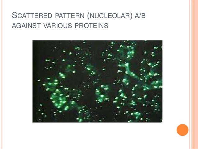Approach to a patient with positive ana levels (2)