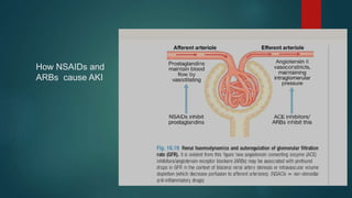 Approach to a patient with raised creatinine - Copy.pptx