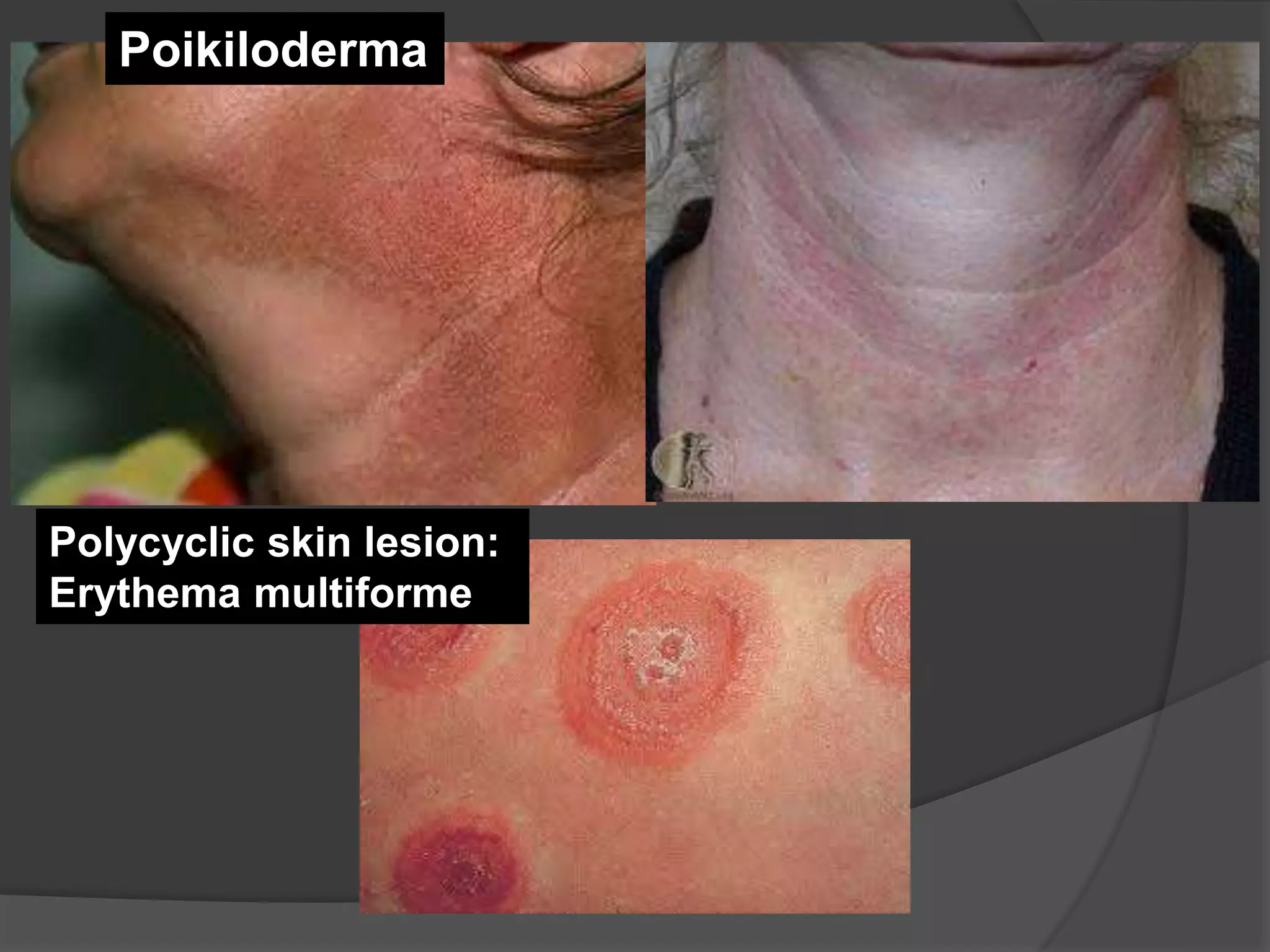 Approach to a patient with skin disorders | PPTX