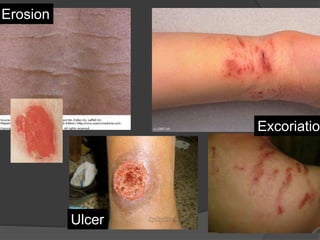 Approach to a patient with skin disorders | PPTX