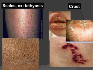 Approach to a patient with skin disorders | PPT