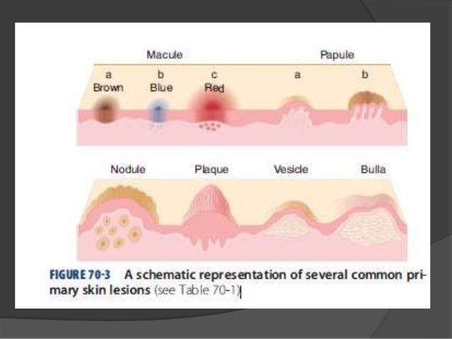 Approach to a patient with skin disorders