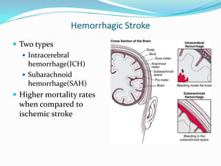 Approach to a patient with stroke - Pathophysiology of stroke | PPTX