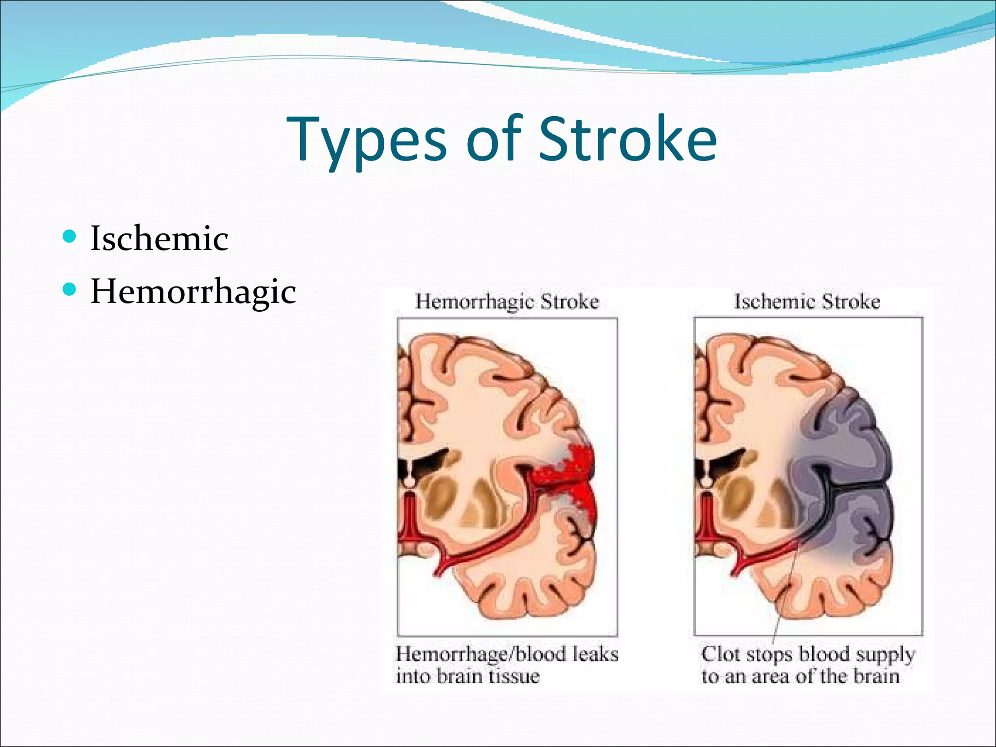 approach to a patient with stroke.pdf