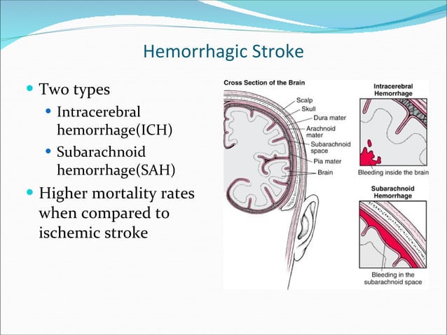 approach to a patient with stroke.pdf