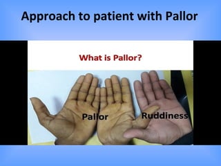 Approach to a pationt with pallor | PPT