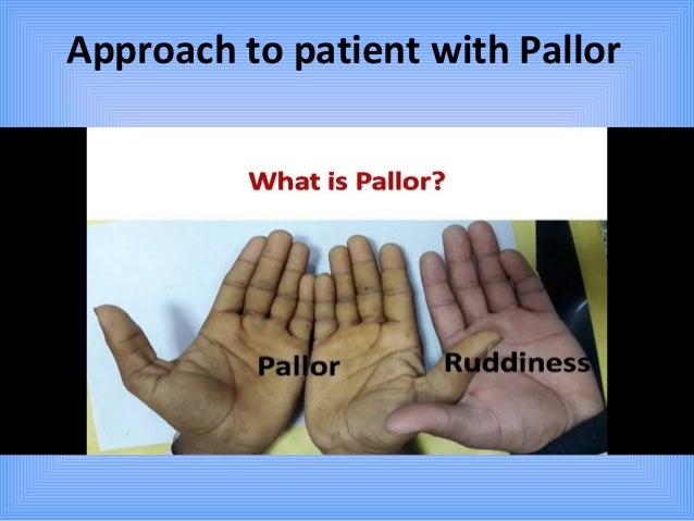 Approach to a pationt with pallor