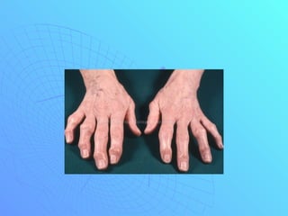 Approach to a rheumatologic patient | PPT
